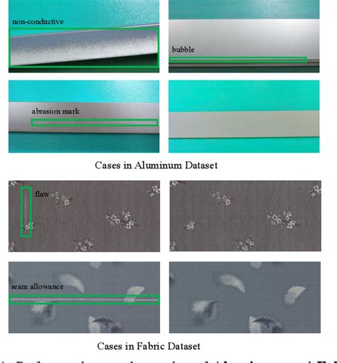 Figure 1 From Reference Based Defect Detection Network Semantic Scholar