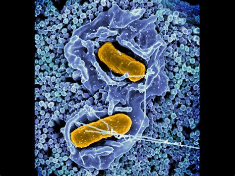 Doxycycline Inducible Gene Switch System For Bacteria Mediated Cancer Therapy Bioworld