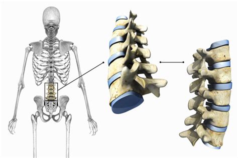 Types Of Cartilaginous Joints