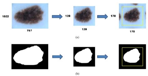 Figure 5 From Classification Of Malignant Or Benign Cancer Using Neural Networks Semantic Scholar