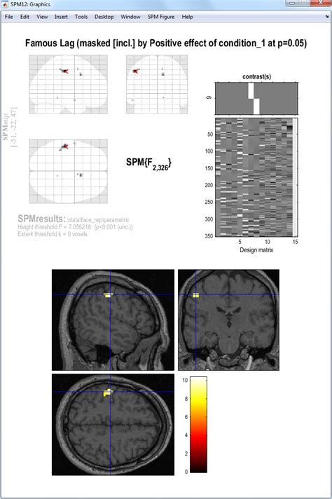parametric modelling spm documentation