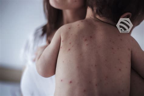 УЛААНБУРХАН ӨВЧНИЙ БАТЛАГДСАН ТОХИОЛДОЛ 5479 БОЛЛОО