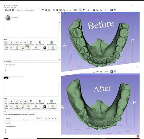 How To Be Able To Edit A 3d Model Stl Keeping High Resolution Of The