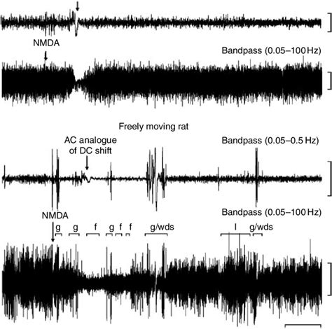 Ecog Recordings Obtained From Anaesthetised And Freely Moving Rats