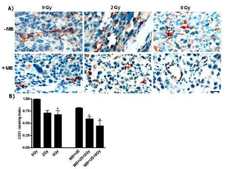 Angiogenesis Assessment With Immunohistochemistry Labeling Of Cd31 A
