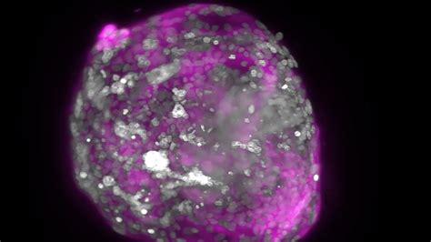 Human Embryo Models Made In Lab The New York Times