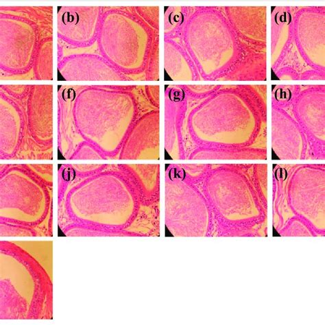 Photomicrograph Of Caput Epididymis Tissue Showing A Control With
