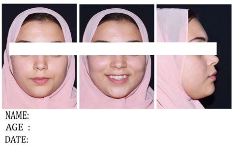 Ortho File Photography Ahmed Marzouk