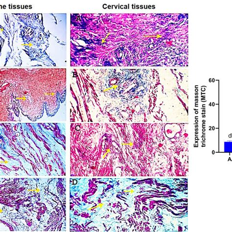 Photomicrographs Of Uterine And Cervical Specimens Showing Expression