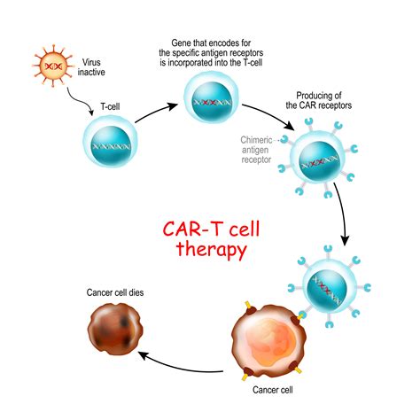 Car T Cell Therapy Locations Car T Cells Effet Secondaire Lfuq