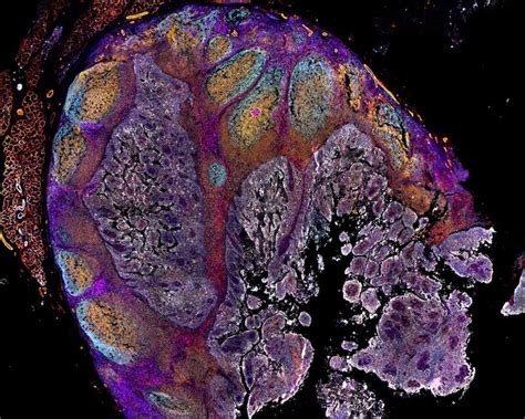 Spatial Imaging System Enables Generation Of High Quality Data Clinical Lab Products