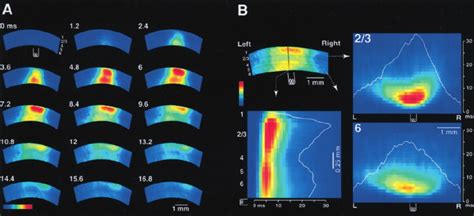 A Spatiotemporal Patterns Of Activation Resulting From Electrical Download Scientific Diagram
