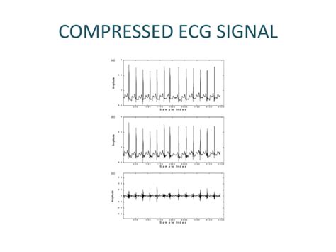 Ecg Compression Using Fft Pptx Digital Audio Computer Software