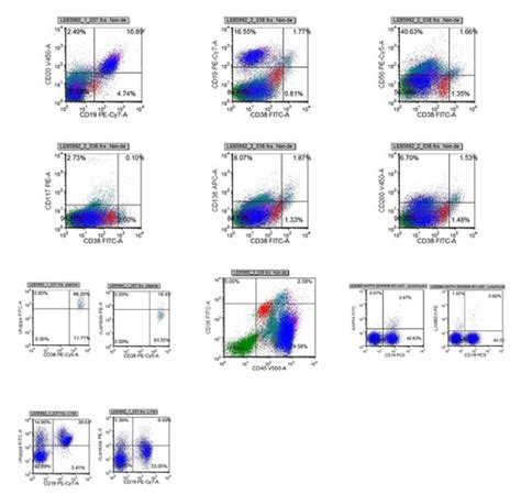 【检验临床面对面】淋巴浆细胞淋巴瘤 华氏巨球蛋白血症1例 肿瘤 检验视界 检验视界网