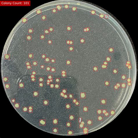 Free Agar Plate Counter Online Colony Counter
