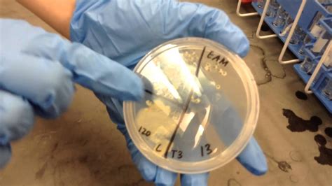 Plate Counting Method Bacteria At Gordon Rowell Blog