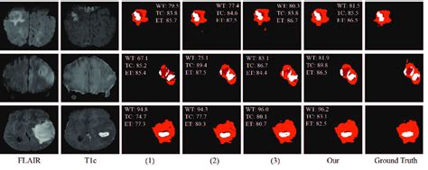 Examples Of The Segmentation Results On Full Modalities On Brats 2019 Download Scientific