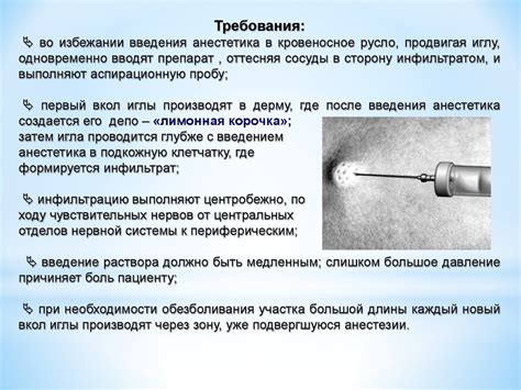 Местная анестезия - презентация онлайн