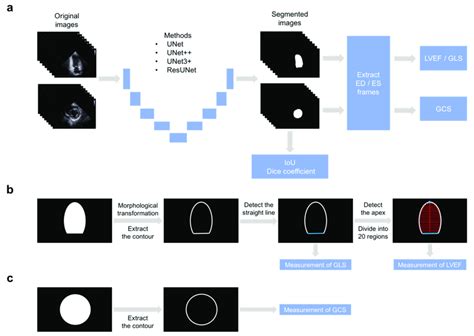 Flow Chart Of Endocardial Border Detection And Left Ventricular