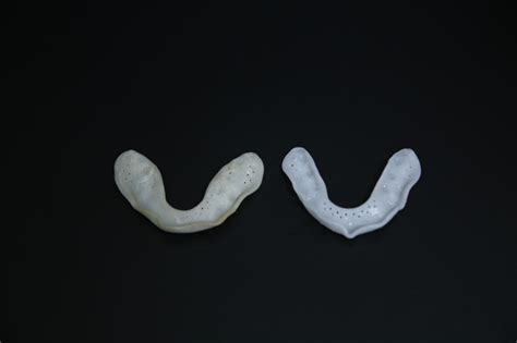 이갈이 방지 마우스피스 1년 반 사용 후기 시수 소바 스트레스가드 추천 추천 왕추천 수면용 일상용 마우스피스 네이버 블로그