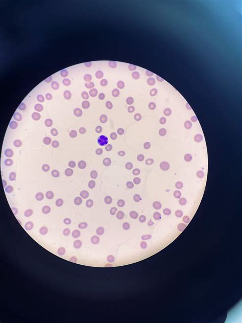 Thato Moropa On Linkedin Medicaltechnology Laboratory Haematology