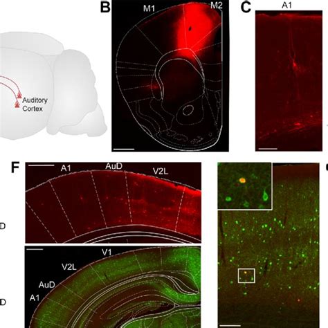 Transsynaptic Tracing Of Projections From Motor Cortex To Primary A1 Download Scientific