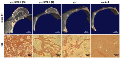 Representative Transversal Micro Ct Reconstructions And Cross Sections