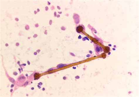 Understanding The Big Threat Of Asbestos Whatlauraloves