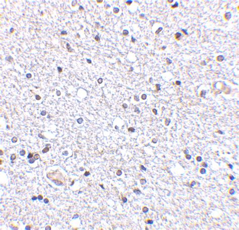 Tslp Polyclonal Antibody Pa5 20320