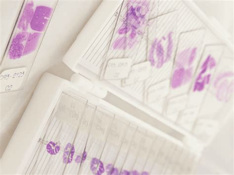 The Digital Revolution In Pathology The Power Of Ai In Computational