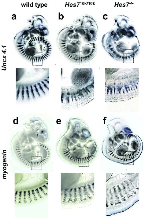 Defects In Somite Segmentation In Hes7 10k10k Mice Expression