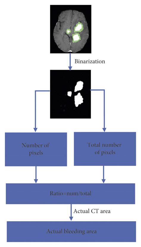Flowchart Of Calculation Of Irregular Hematoma Volume Download Scientific Diagram