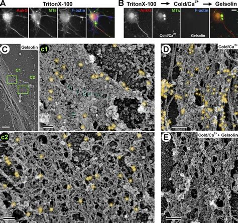 Structure Of Ais Coat After Actin Filament And Mt Extraction A And B Download Scientific