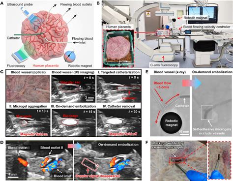 Swarming Self Adhesive Microgels Enabled On Demand Embolization In Ex Download Scientific