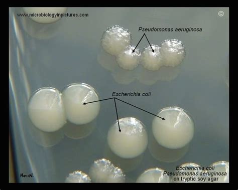 Streak Plate Method Patterns Procedure Principle