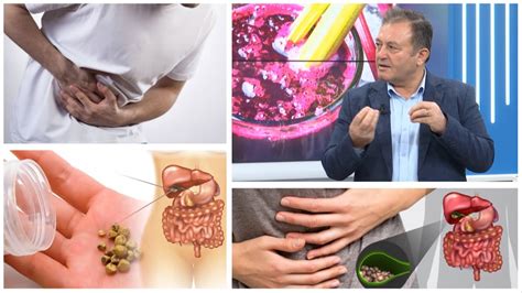 Gurët Në Tëmth Si Ti Nxjerrim Pa Kirurgji Me Bimë E Erëza Që Ka Shtëpia Ylli Merja Jep