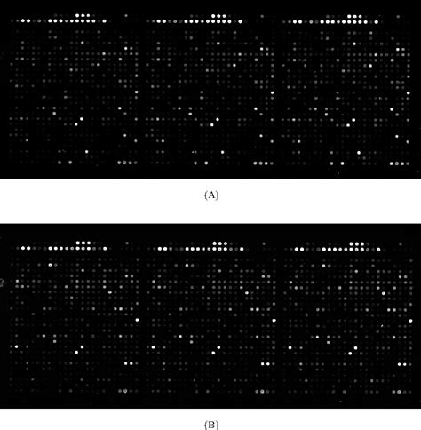 Figure From Computational Strategies For Analyzing Data In Gene Expression Microarray
