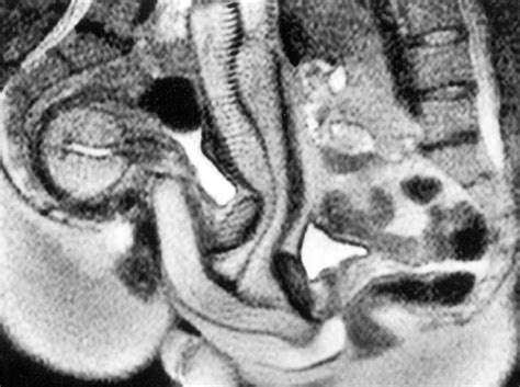 Couples Mri Sex Reveals Groundbreaking Anatomy Discovery Nz Herald