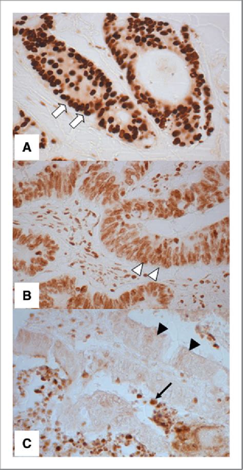 Figure 1 From Stat3 Expression Molecular Features Inflammation
