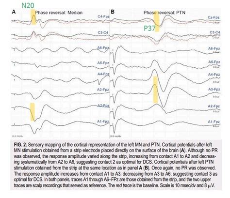 Motor Mapping When Phase Reversal Is Not Clearly Identified
