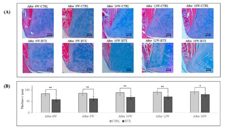 A Massons Trichrome Stained Yz Cross Sections Of Rat Mandibles In Download Scientific