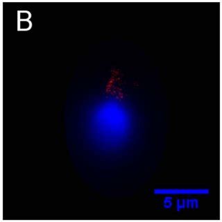 Fluorescent images of sperm stained with DAPI DNA dye and anti γH2AX Download Scientific