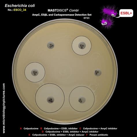 Escherichia Coli Esbl Mastdiscs Combi