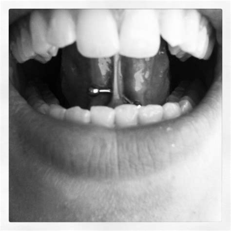 Tongue Frenulum On Tumblr