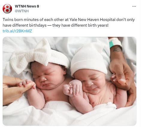 Twins Born In Two Different Years Rdamnthatsinteresting