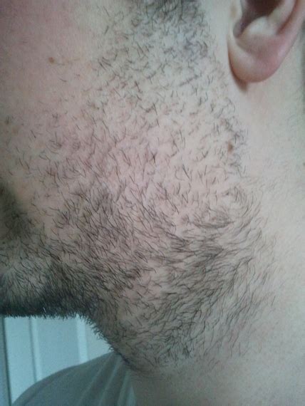 Patchy Cheeks Any Hope Beard Board