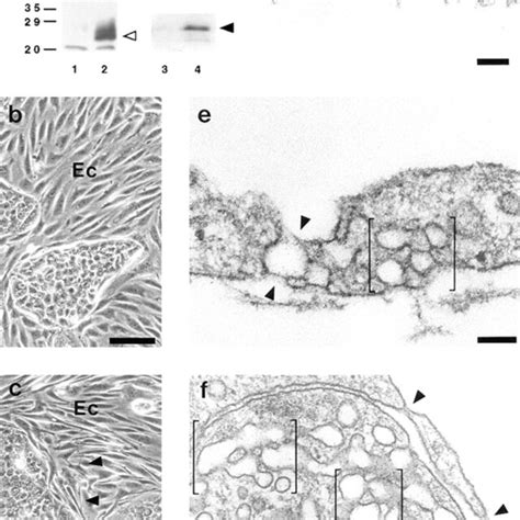 Coculture Of Ace Cells With Isolated Choroid Plexus Epithelial Cells
