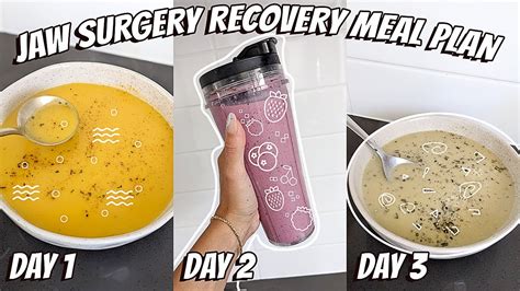 Liquid Food For Jaw Surgery At Crystal Yazzie Blog