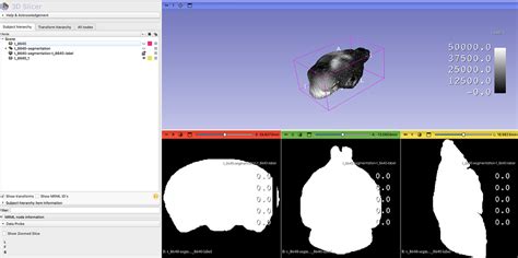 Converting Vtk To Dicom Support 3d Slicer Community