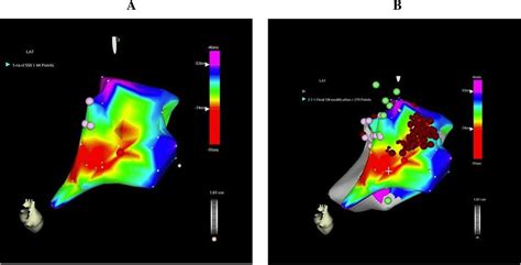 Sinoatrial Node Is A Long Structure With Slower More Caudal Portion Of Download Scientific